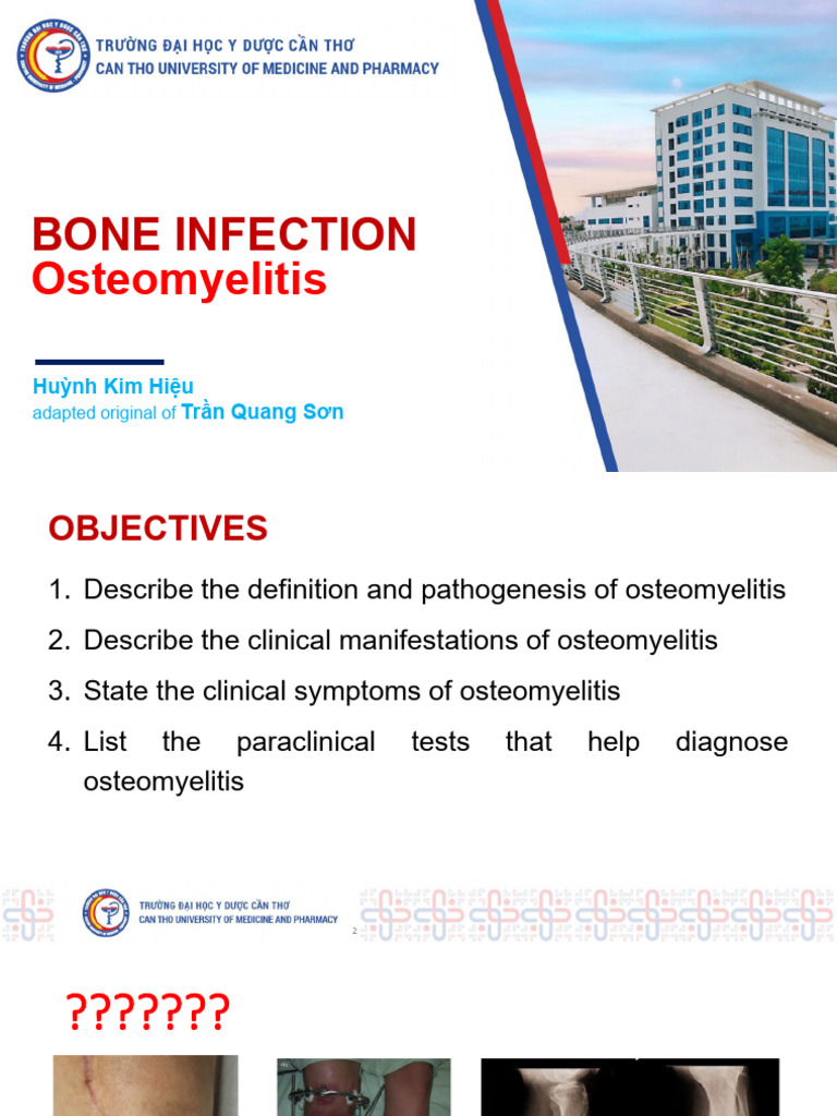 12.bone Infection Osteomyelitis | PDF