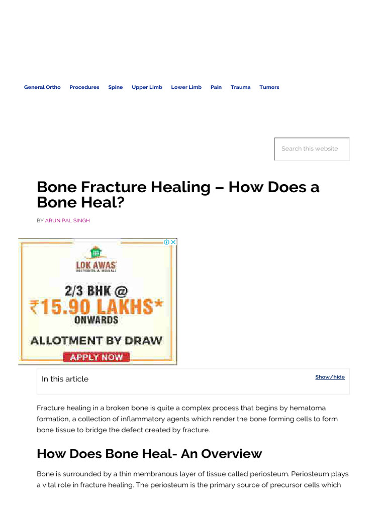 Bone Fracture Healing - How Does A Bone Heal - Bone and Spine (1) - 1 ...