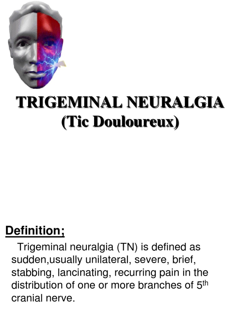 Trigeminal Neuralgia (Tic Douloureux) | PDF | Clinical Medicine | Neurology