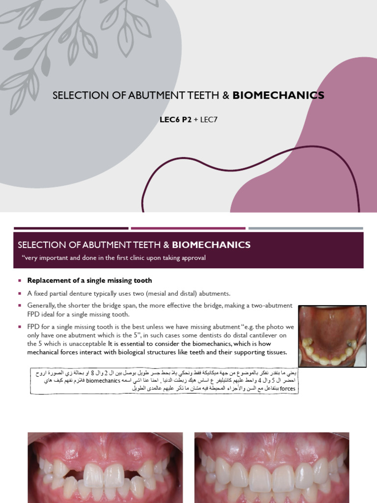Prostho Lec6 p2 | PDF | Dental Anatomy | Dental Implant