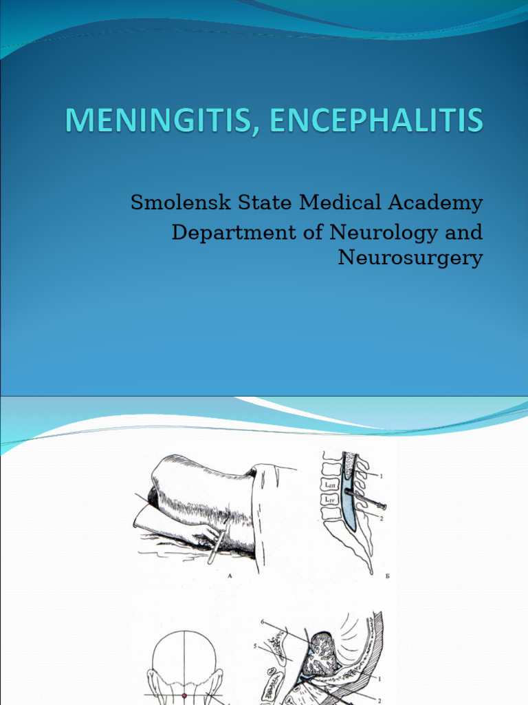 Meningitis, Encephalitis | PDF | Meningitis | Cerebrospinal Fluid