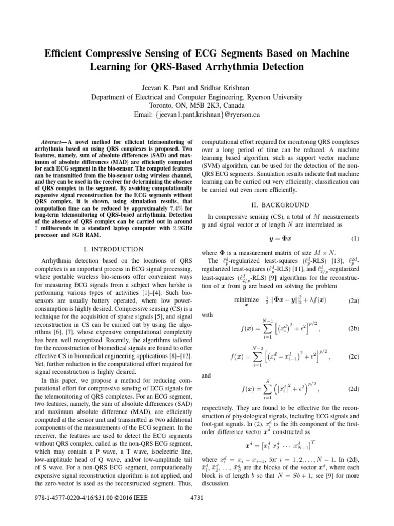 Efficient Compressive Sensing of ECG Segments Based on Machine Learning for QRS-based Arrhythmia ...