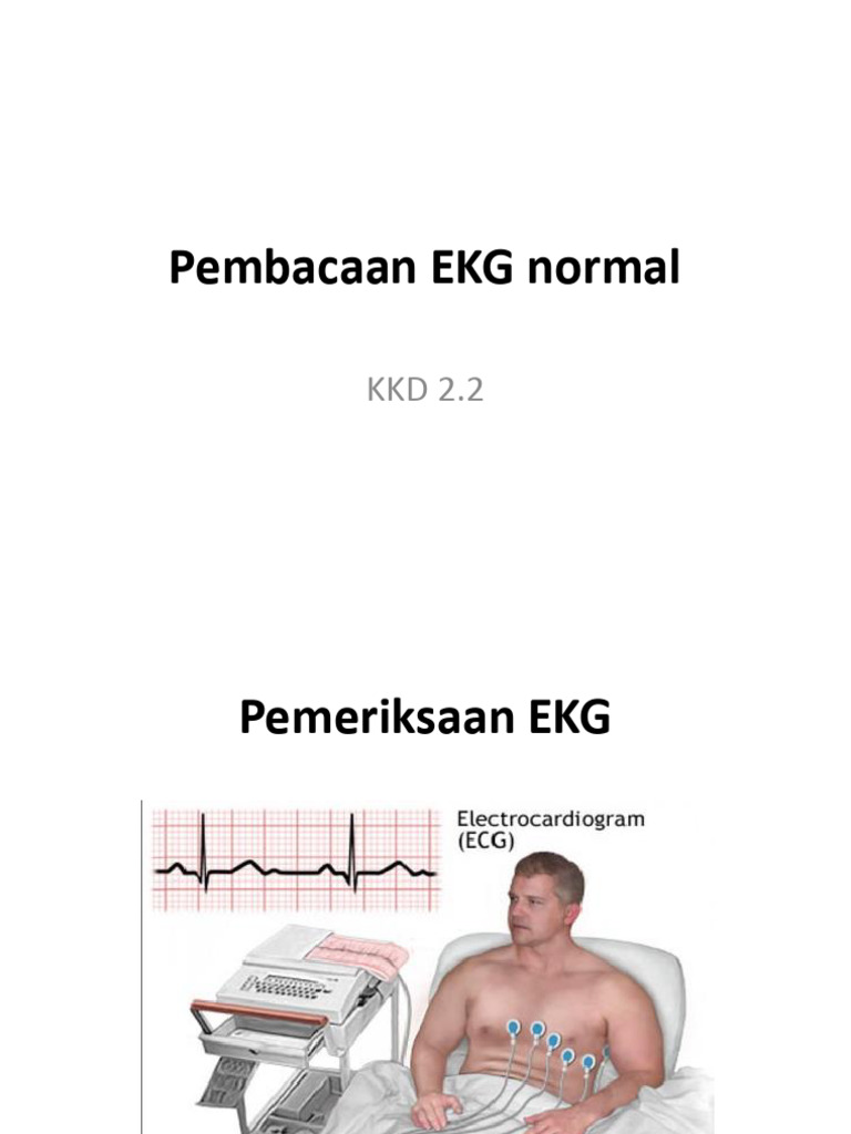 Panduan Membaca EKG Normal | PDF