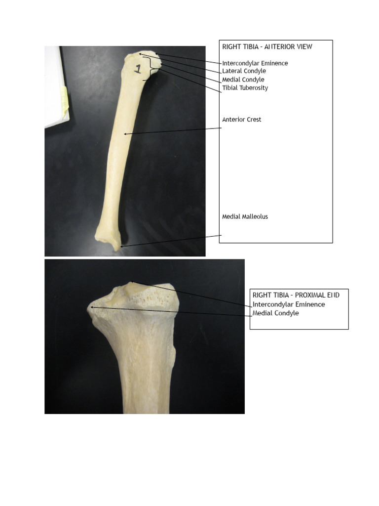 Appendicular Bones - 97-2003 | PDF | Anatomical Terms Of Location ...