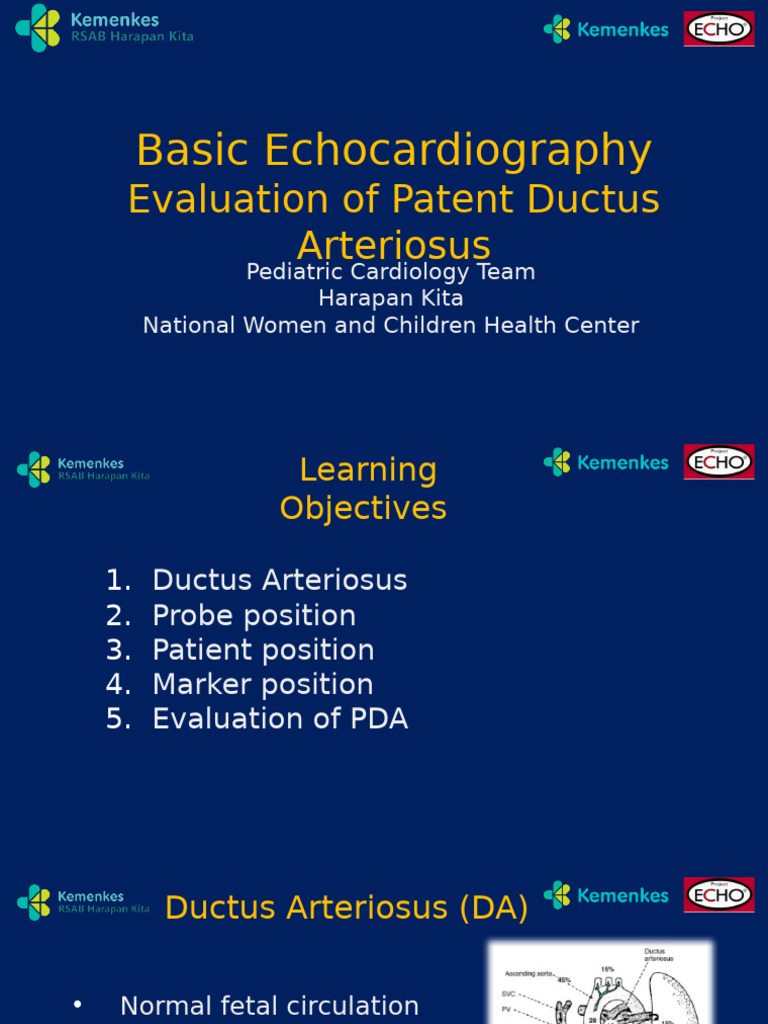 Basic Echocardiography - Patent Ductus Arteriosus | PDF