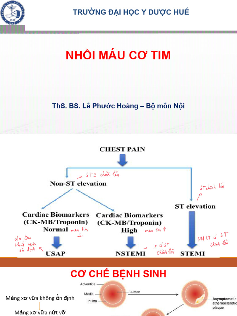NH I Máu Cơ Tim | PDF