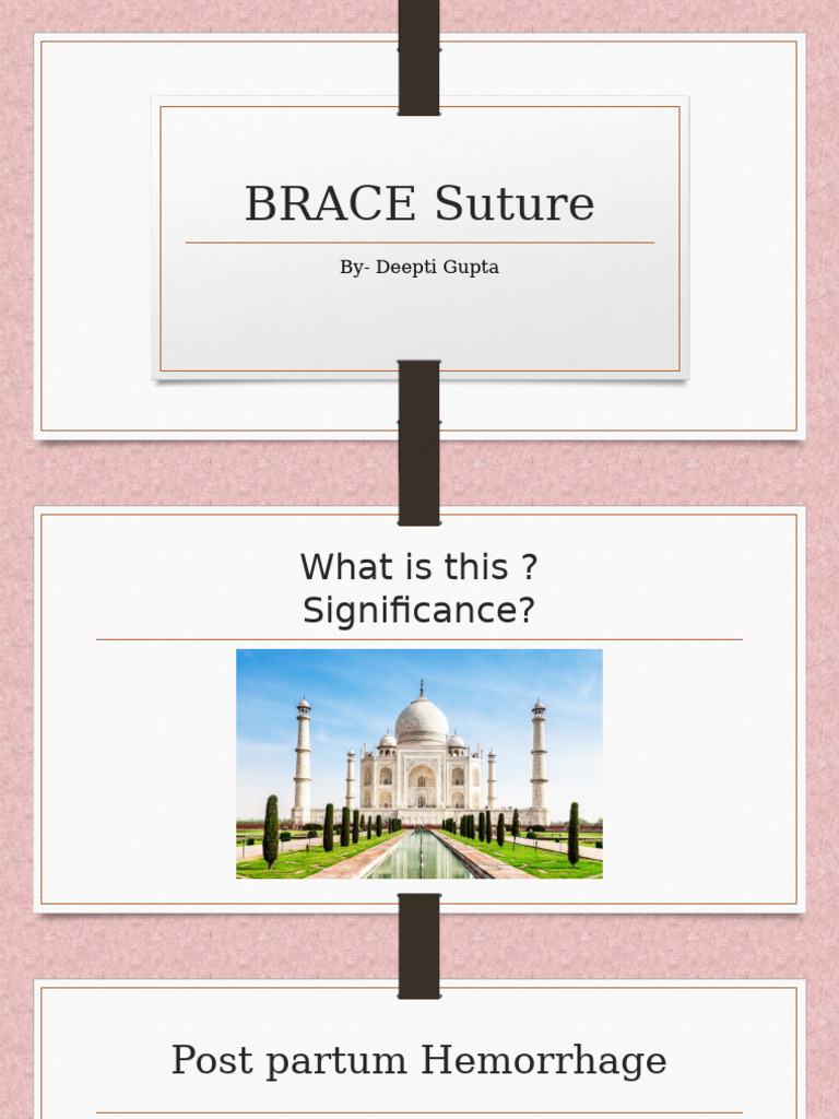 Brace Suture | PDF