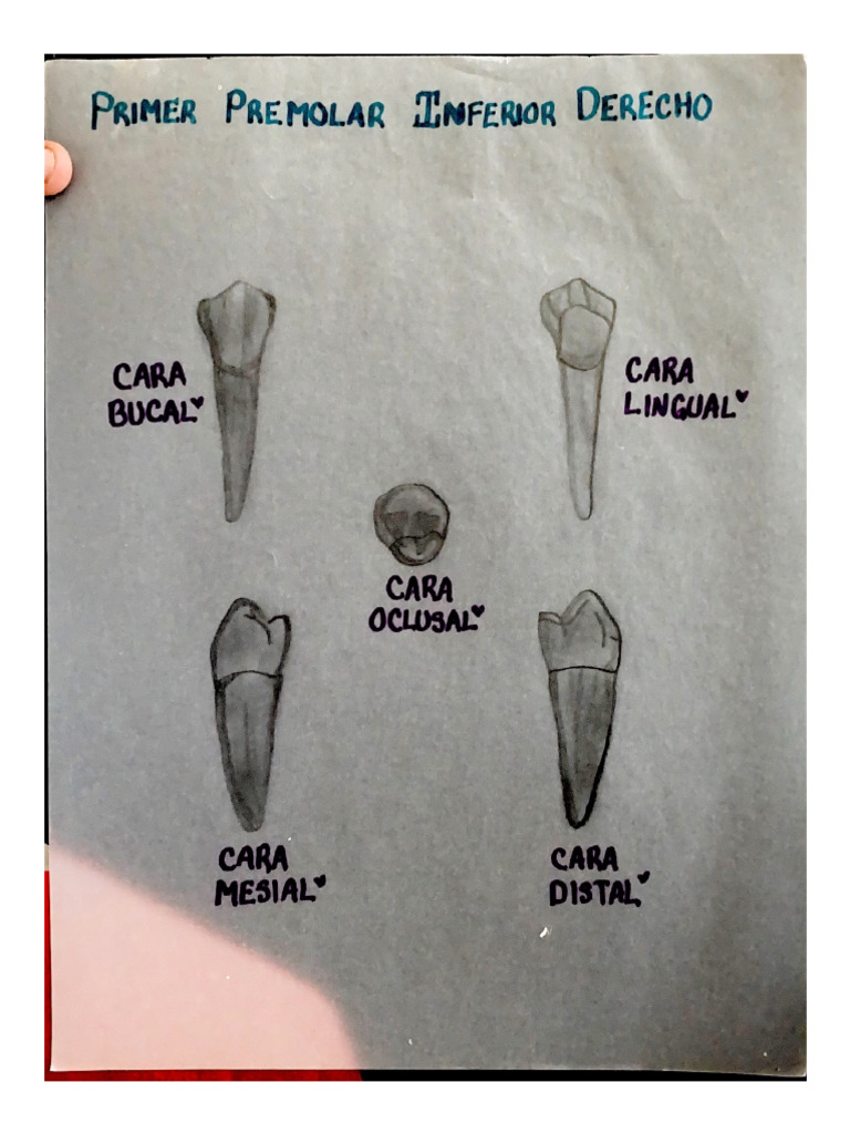 Modelado de Dientes | PDF