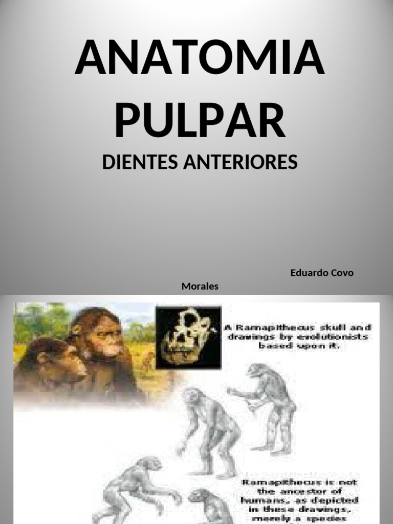 Anatomia Pulpar de Dientes Anteriores | PDF