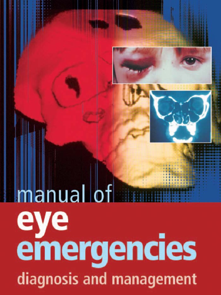 Manual of Eye Emergencies Diagnosis and Management | PDF | Cornea ...