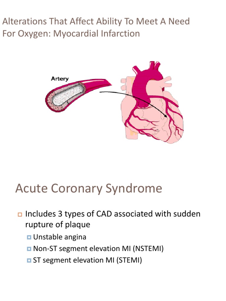 Myocardial Infarction | Myocardial Infarction | Angina Pectoris