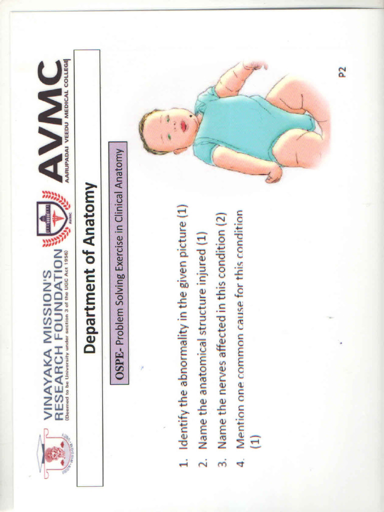 OSPE Problem Solving | PDF