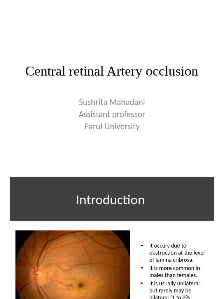 Central Retinal Artery Occlusion Guide | PDF | Retina | Vision