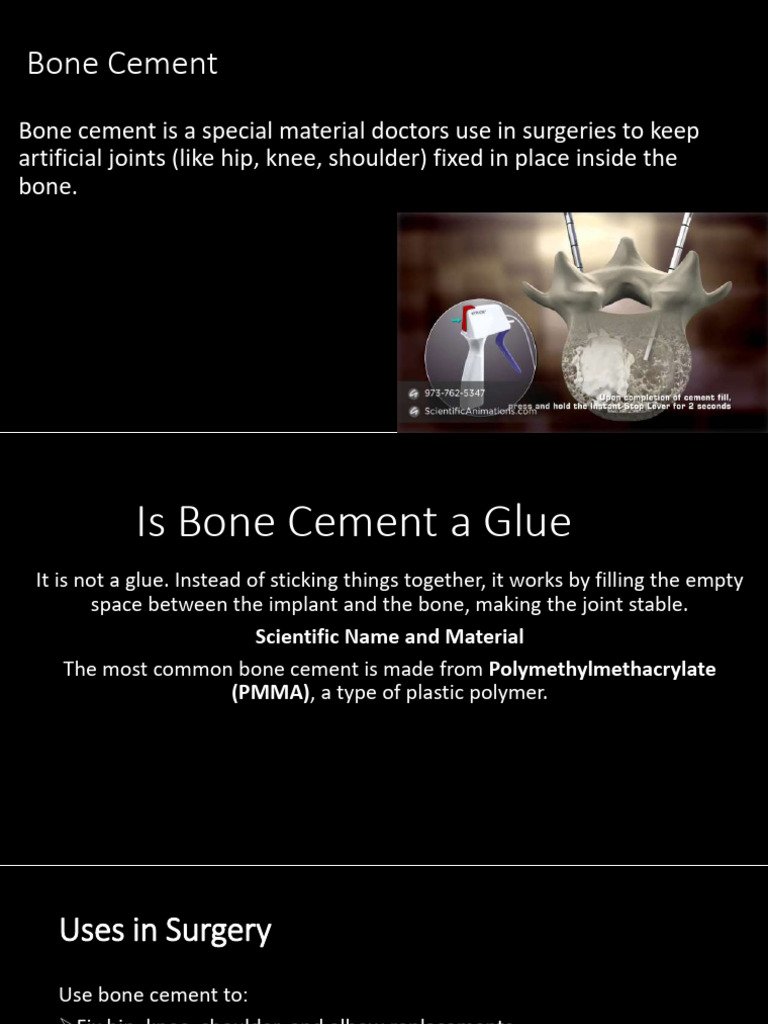 Understanding Bone Cement in Surgery | PDF