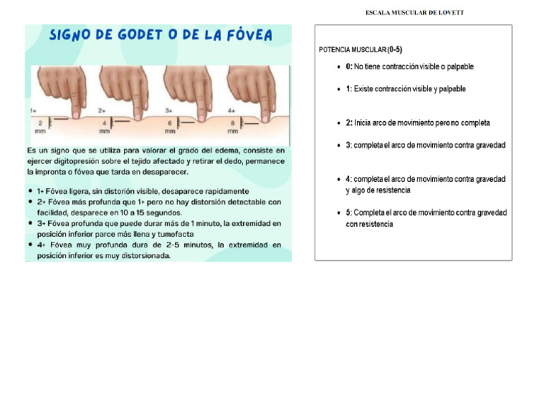 Signo de Godet | PDF