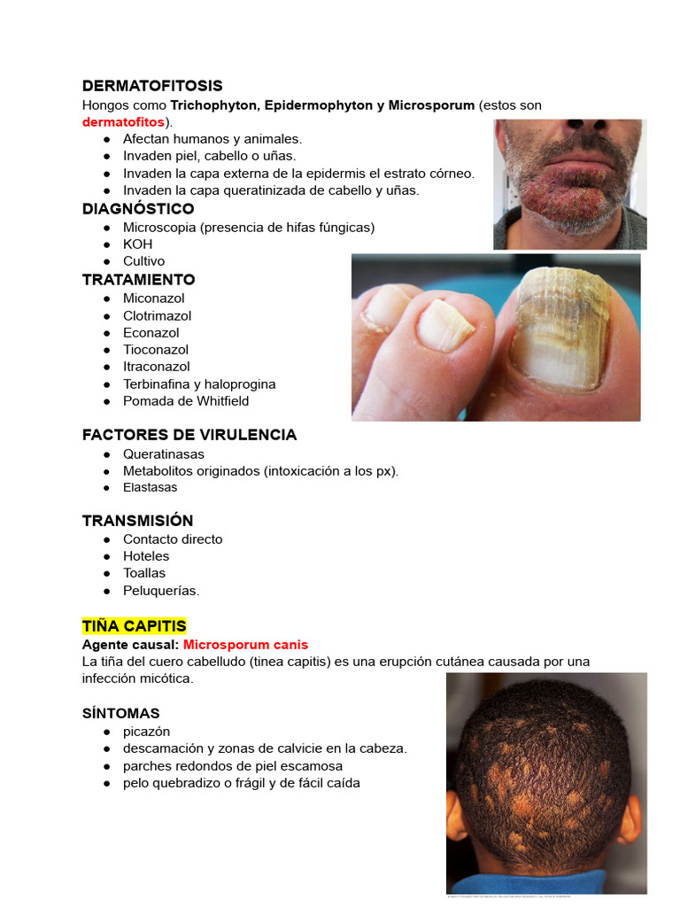 Guía Completa sobre Dermatofitosis y Tratamientos | PDF | Condiciones ...
