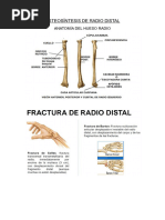 Cerclaje de Rótula: Técnica Quirúrgica | PDF | Articulación | Rodilla