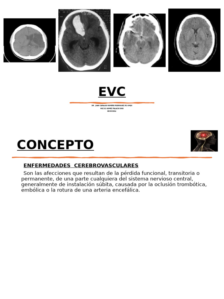 Evc Juan Carlos Romero RDZ | PDF | Carrera | Isquemia