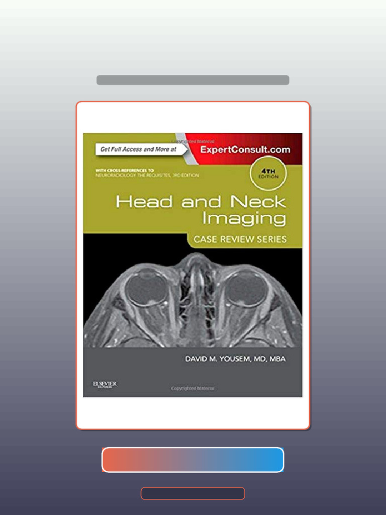 Head and Neck Imaging by David M Yousem MD MBA Ebook and TestBank ...