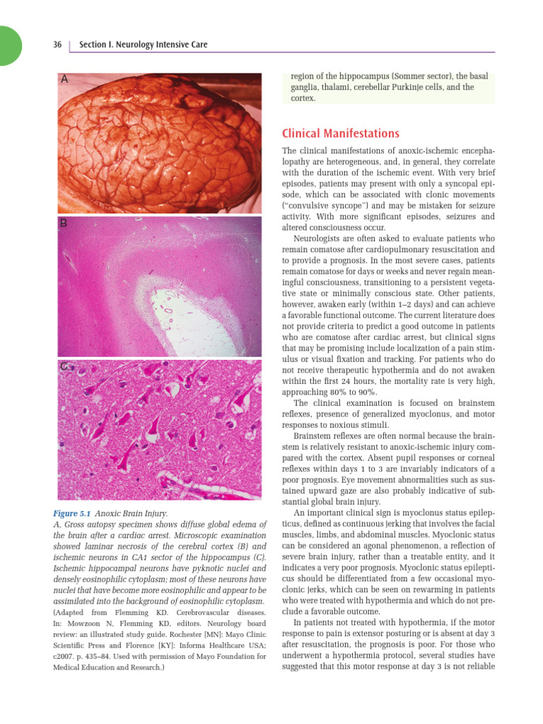 487061316-Mayo-Clinic-Neurology-Board-Review-Clinical-Neurology-for ...