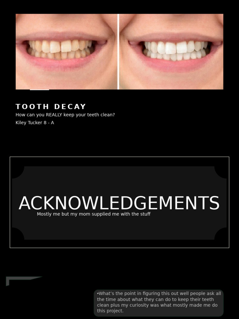 Tooth Decay Wit Eggs | PDF | Soft Drink