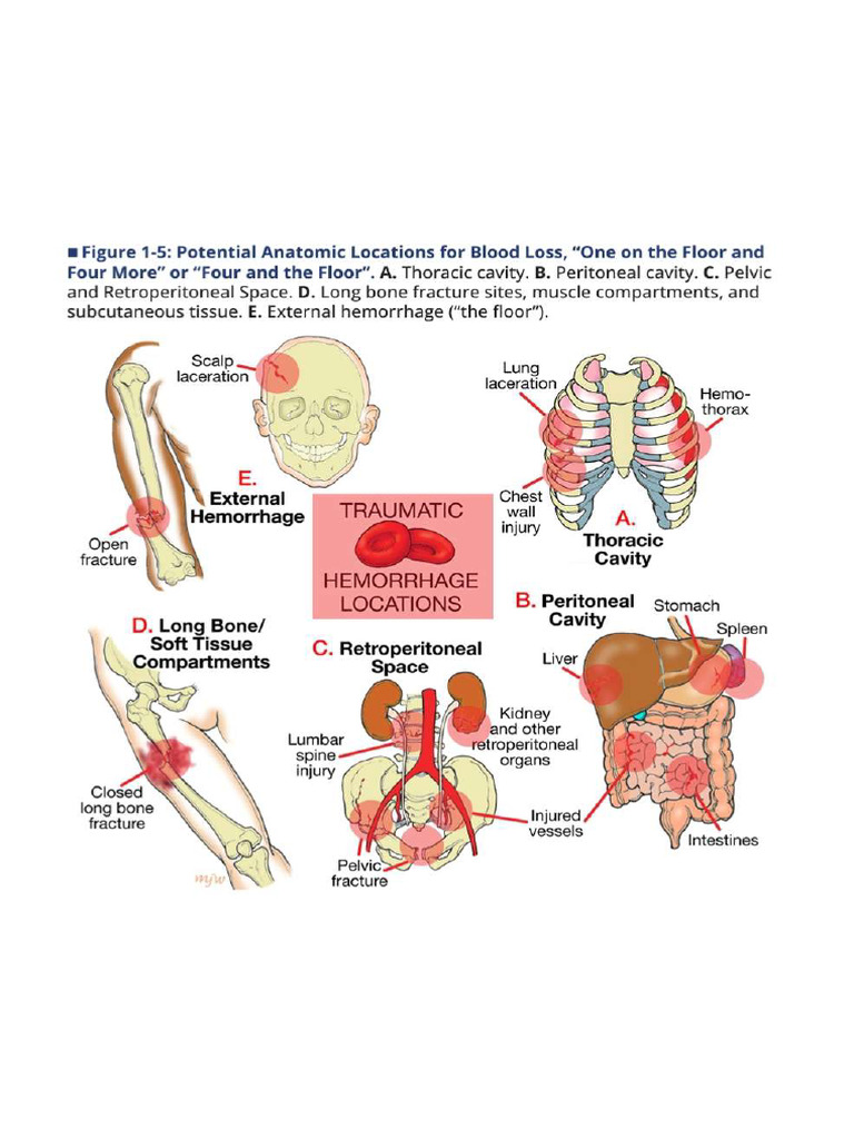 ATLS Notes 1 | PDF