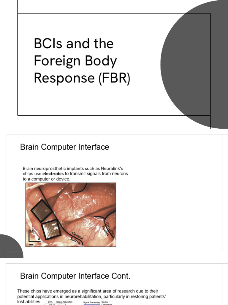 Foreign Body Response and BCIs | PDF