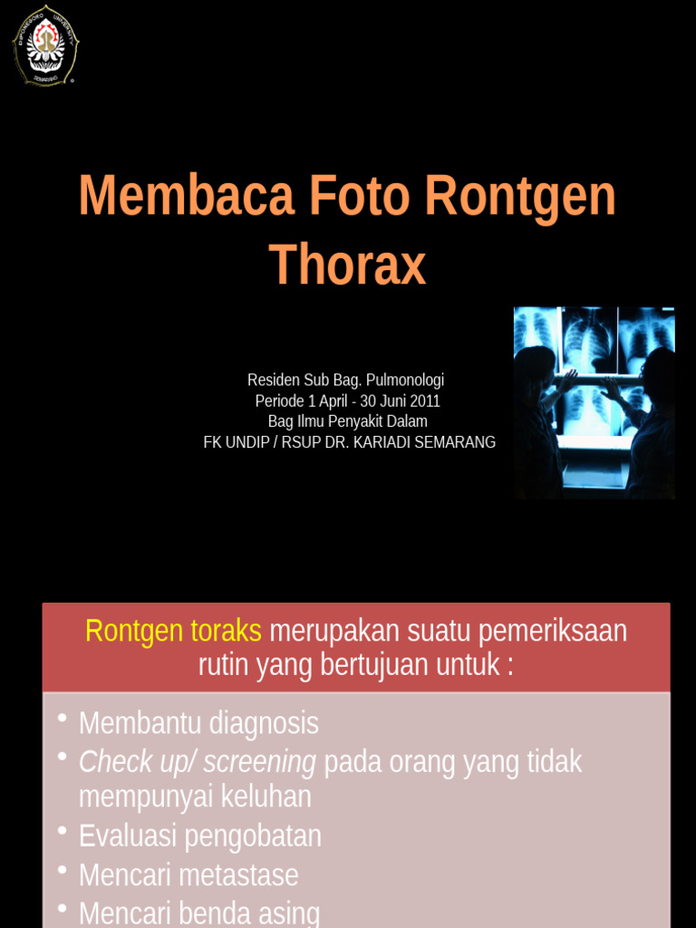 Panduan Membaca Foto Rontgen Thorax | PDF
