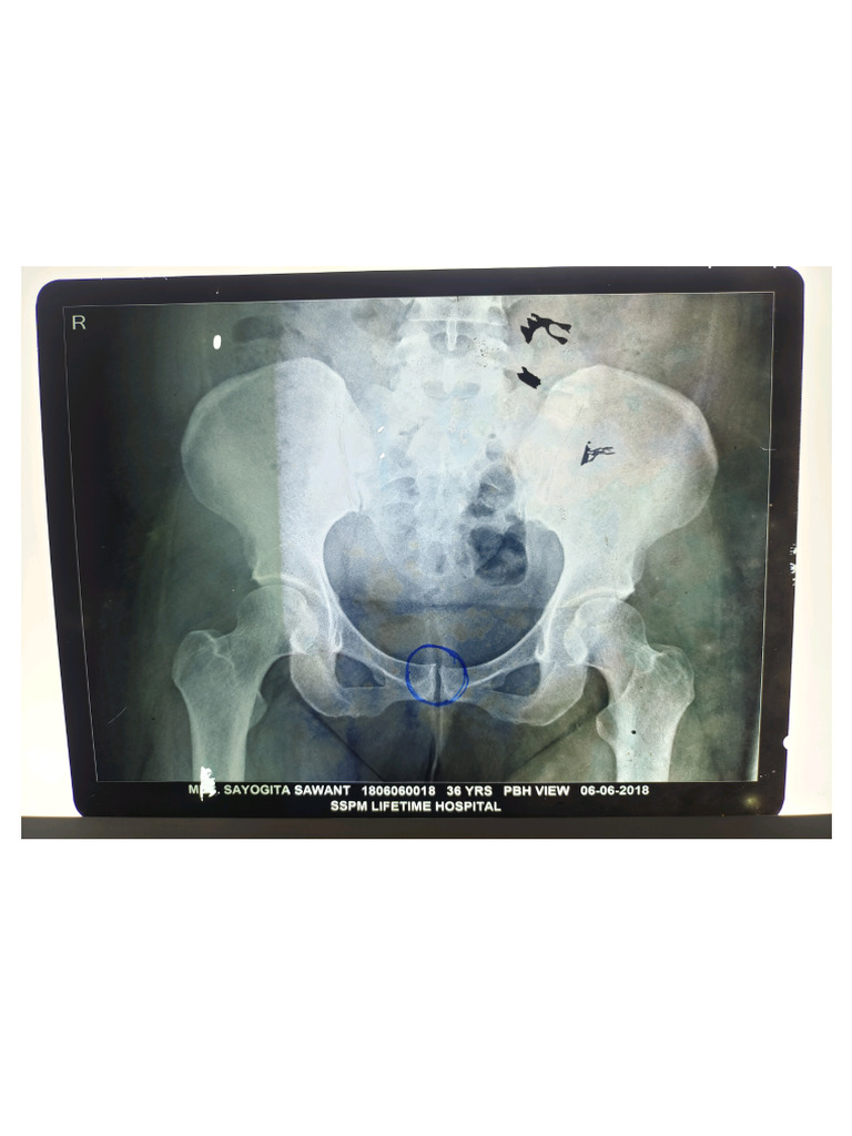 X RAYS For Practical of SSPM College Under Sujj | PDF