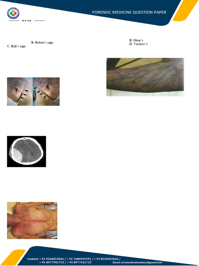 Forensic Medicine Exam Questions | PDF | Autopsy | Vagina