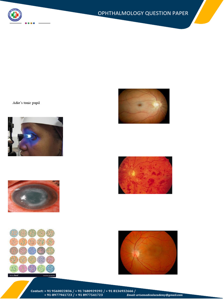 Ophthalmology Question Paper and Management Guide | PDF | Cataract ...