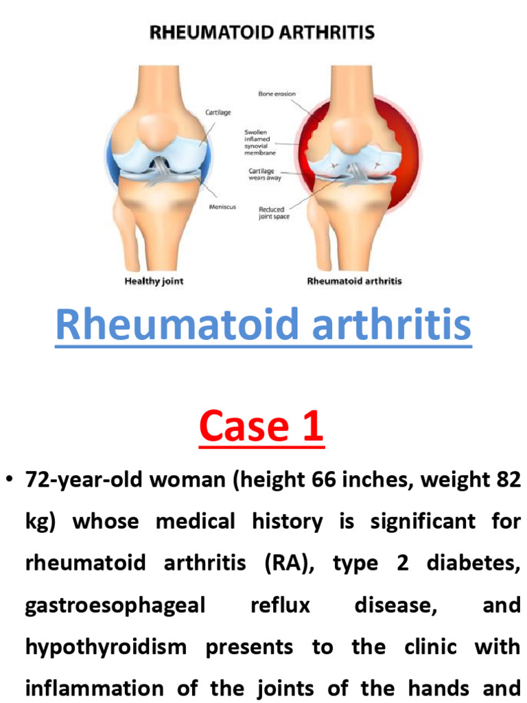 Lab 6 Geriatric (Rheumatoid Arthritis&Osteoarthritis) | PDF | Rheumatoid Arthritis | Osteoarthritis