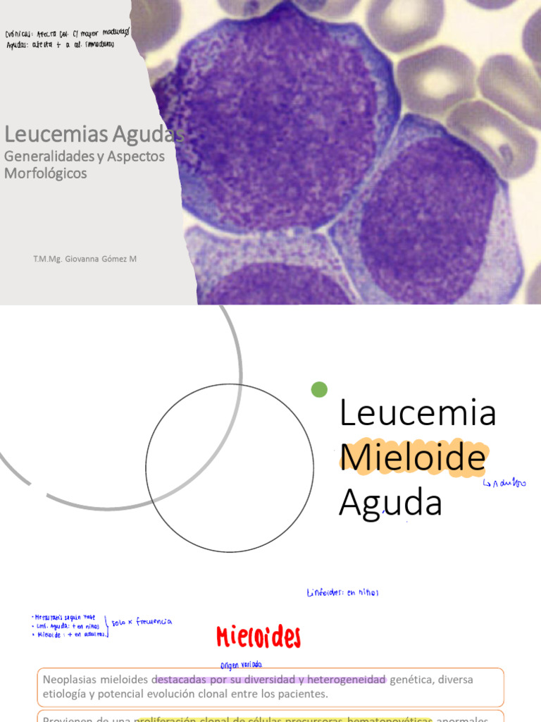 Clase 11 Leucemias Agudas 2024 | PDF | Leucemia | Especialidades Medicas