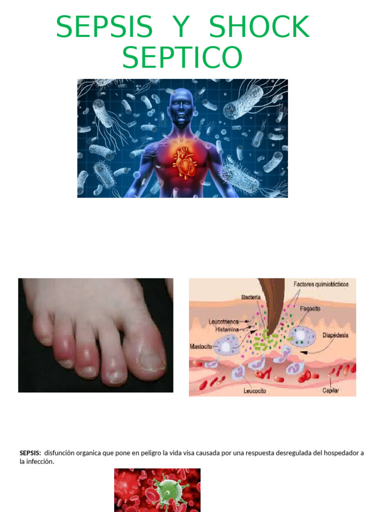 Sepsis y Shock Septico | PDF