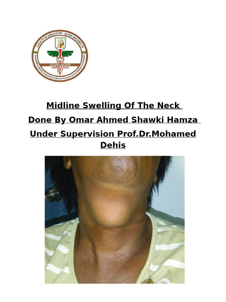 Midline Swelling of The Neck | PDF | Thyroid | Neck