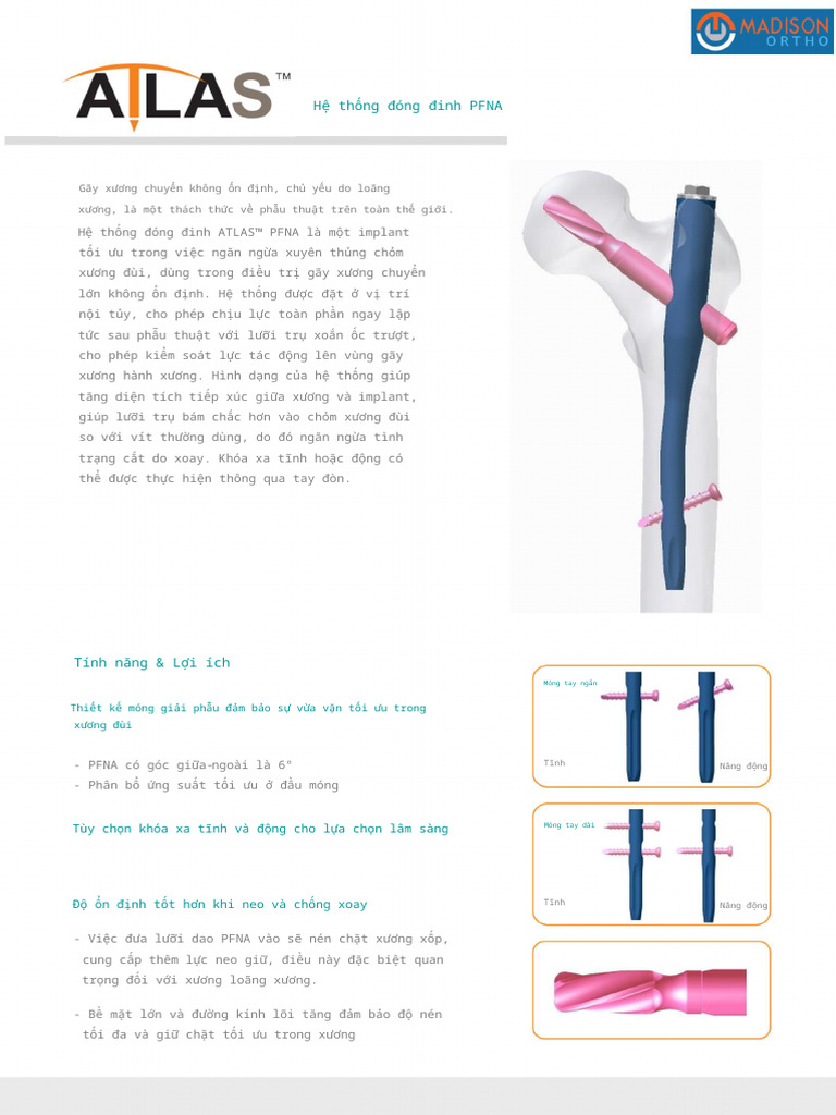 Atlas Pfna Nail2 | PDF