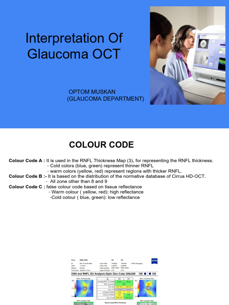 Glaucoma OCT Interpretation Guide | PDF | Vision