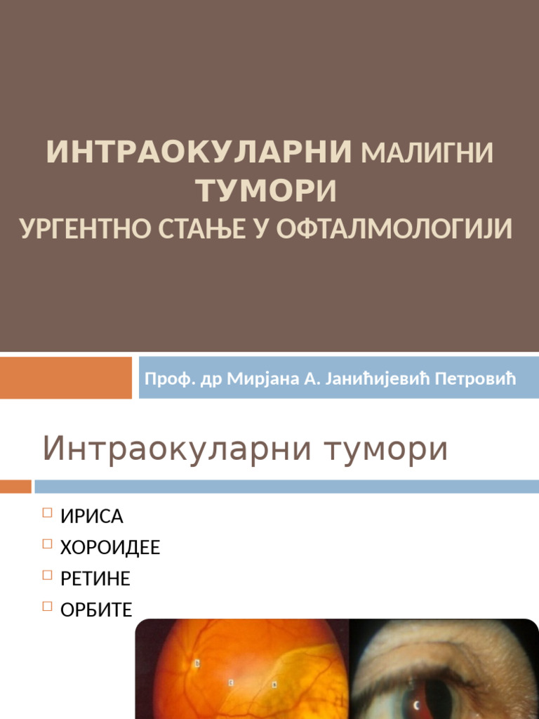 Oftal Tu - Oka | PDF