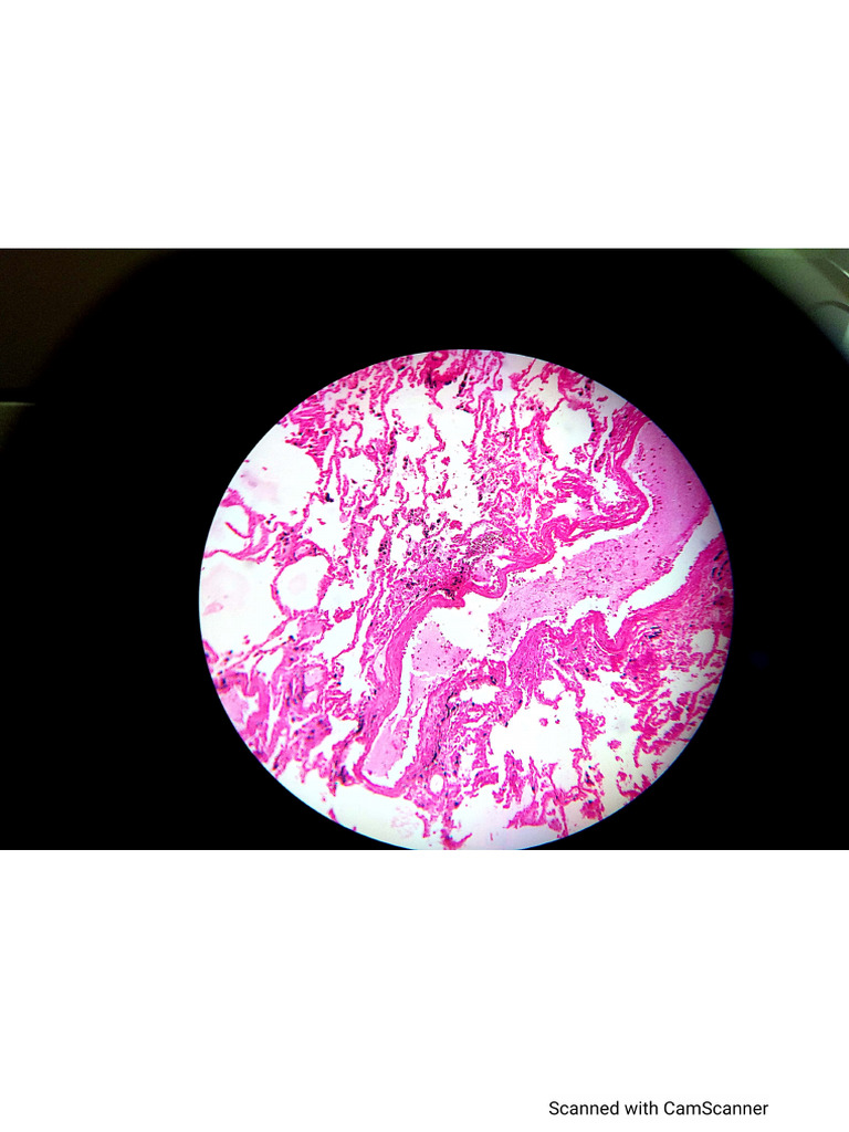 Pathology Microscopic Slides (Spotters and Discussion) | PDF