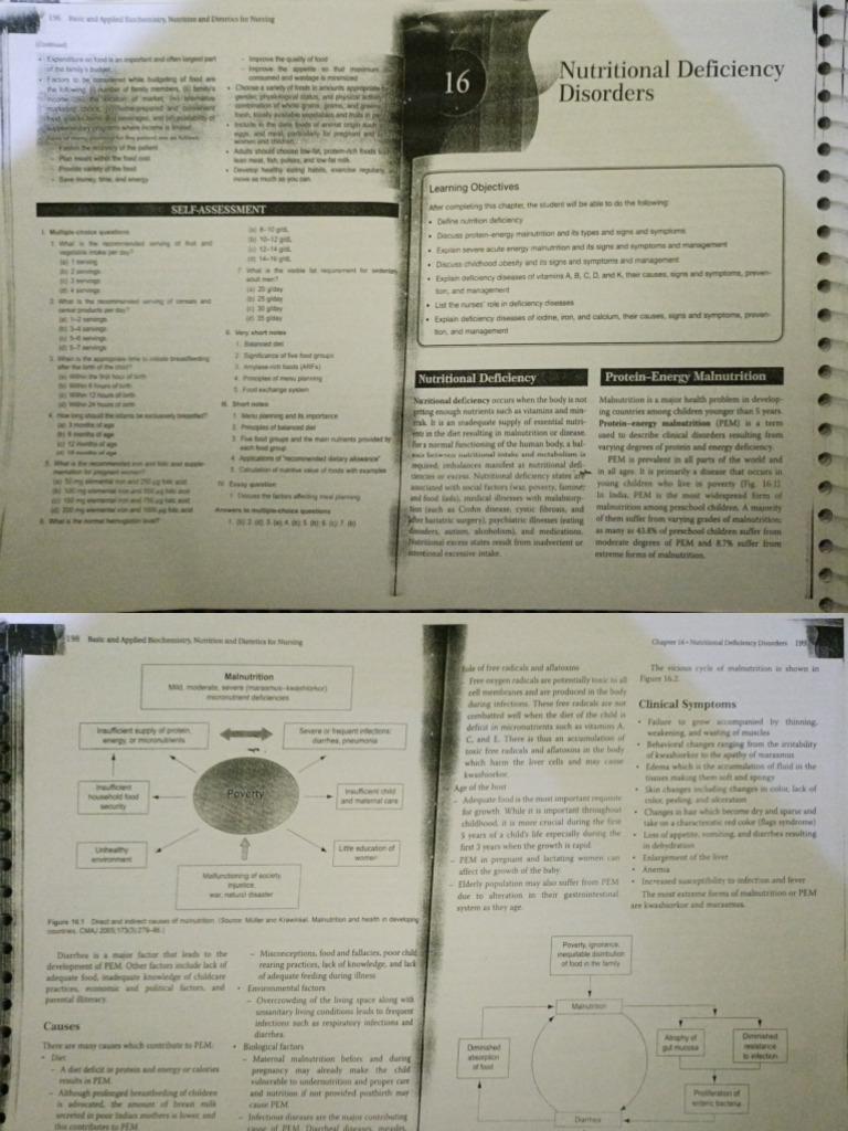 Nutritional Deficiency and Malnutrition Guide | PDF | Determinants Of ...