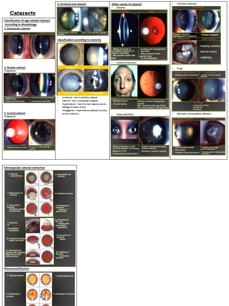 Cataracts | PDF