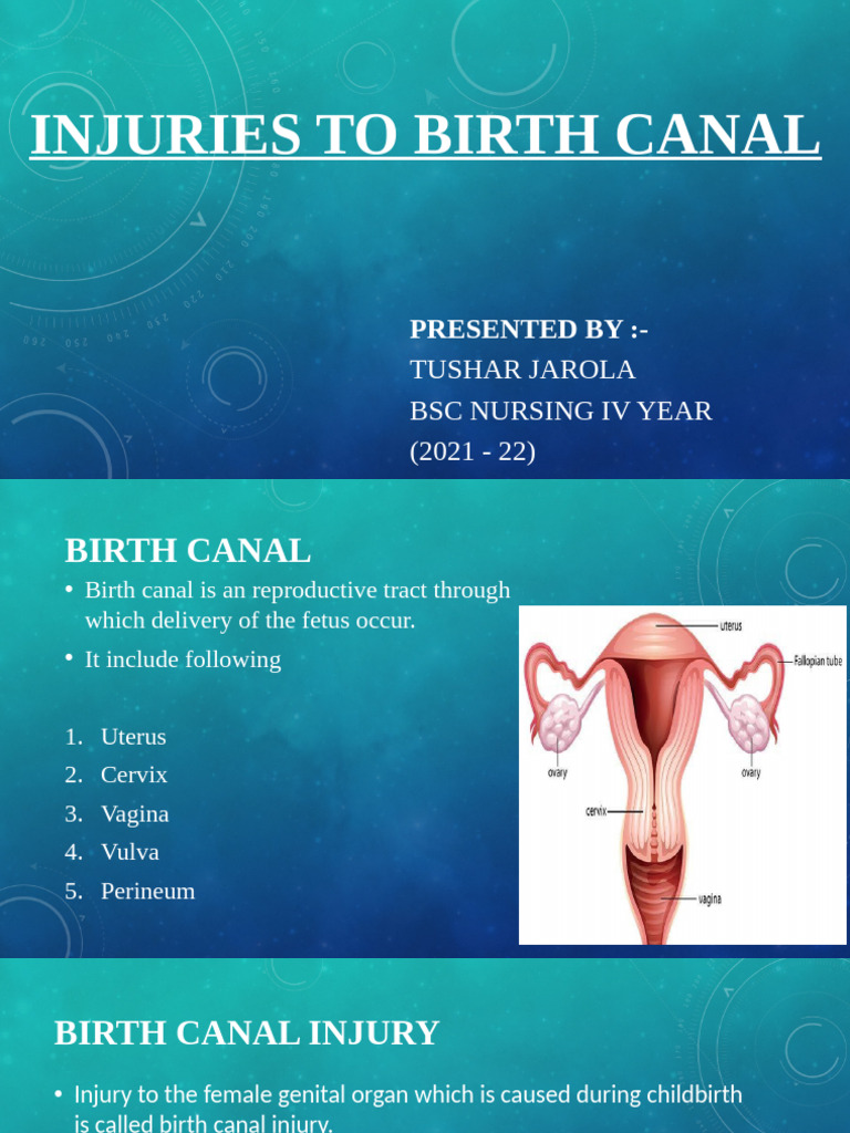 Birth Canal Injuries Overview | PDF | Vagina | Childbirth