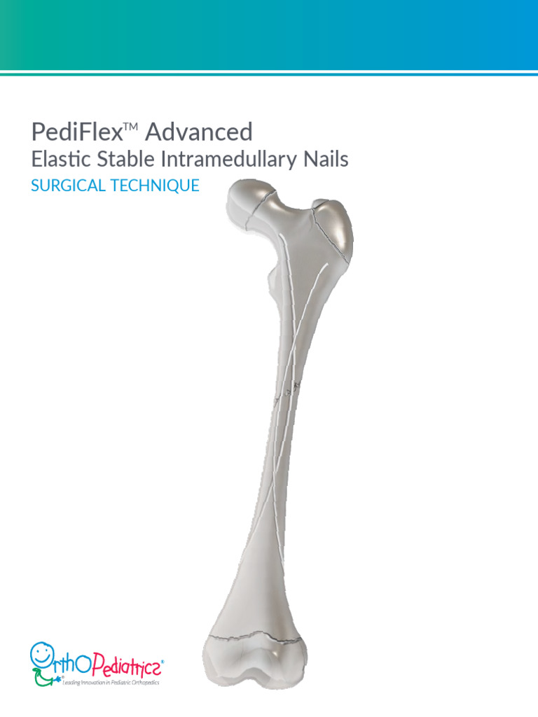 PediFlex™ Intramedullary Nail Technique | PDF | Implant (Medicine) | Screw