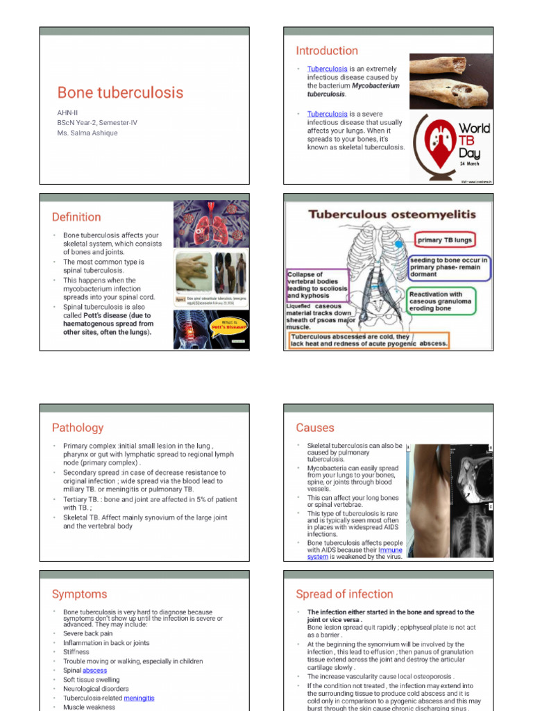Bone Tuberculosis - Phoenix | PDF