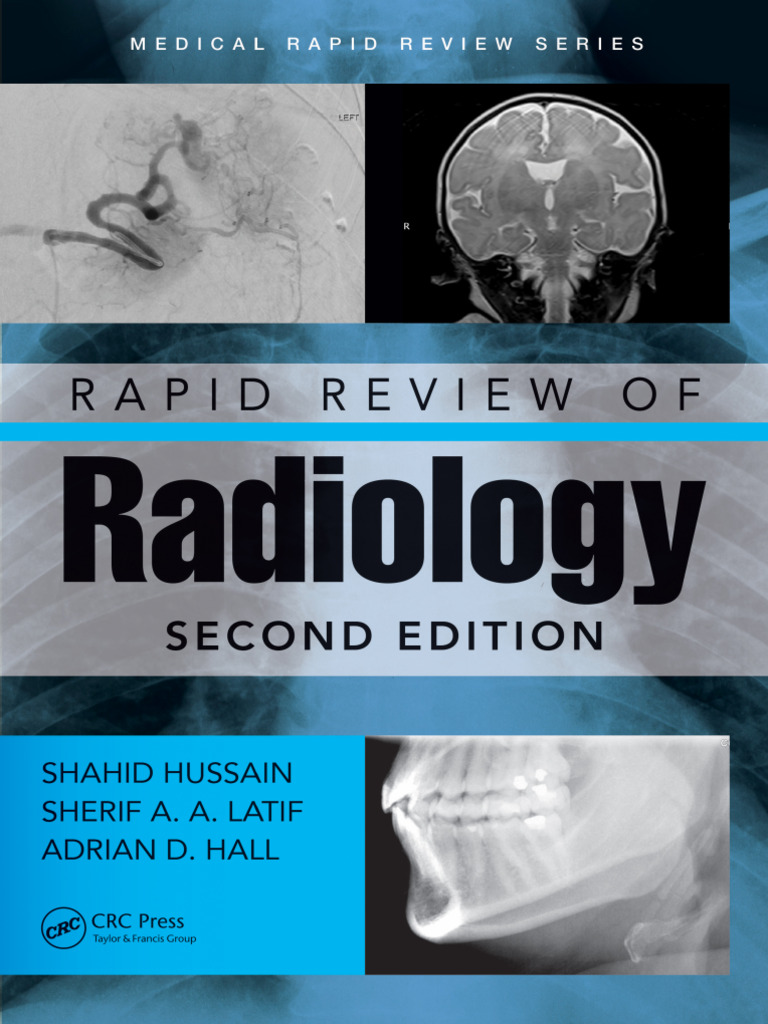 Updated Rapid Review of Radiology 2nd Ed. | PDF | Radiology | Lung