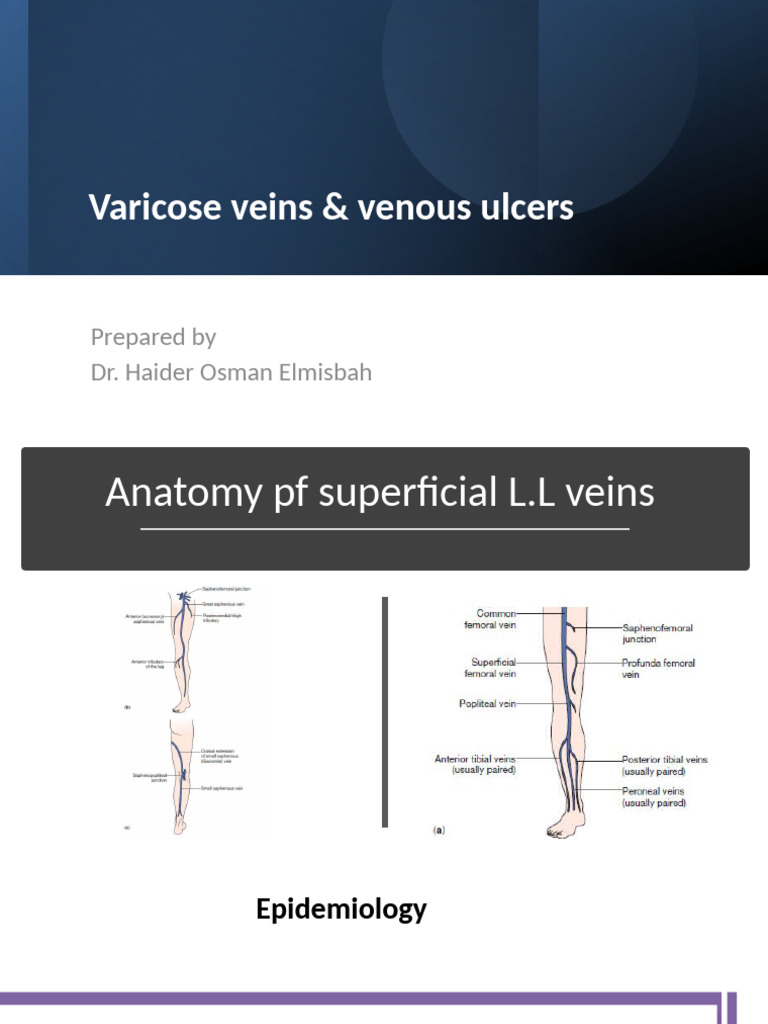 Varicose Veins and Ulcers - Copy 1 | PDF | Varicose Veins | Vein