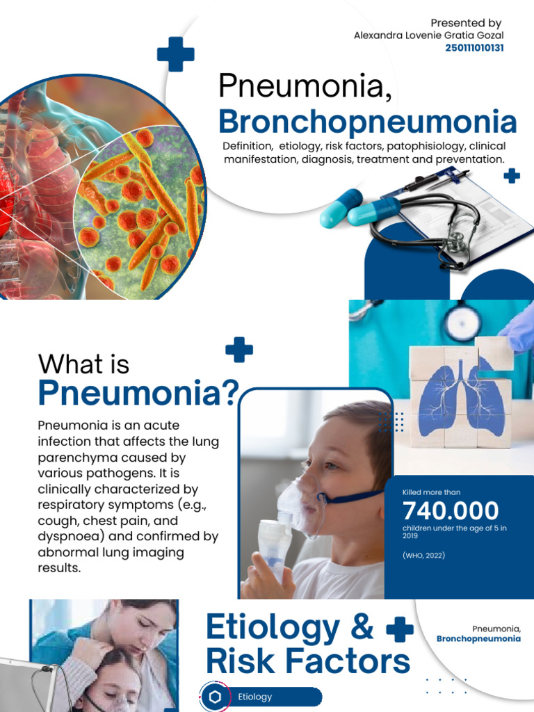 25-131 Alexandra L. G. Gozal Pneumonia, Bronchopneumonia | PDF | Pneumonia | Respiratory Diseases