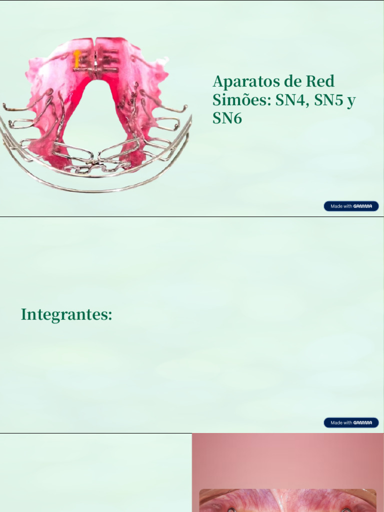 Aparatos-de-Red-Simoes-SN4-SN5-y SN6 | PDF | Ortodoncia