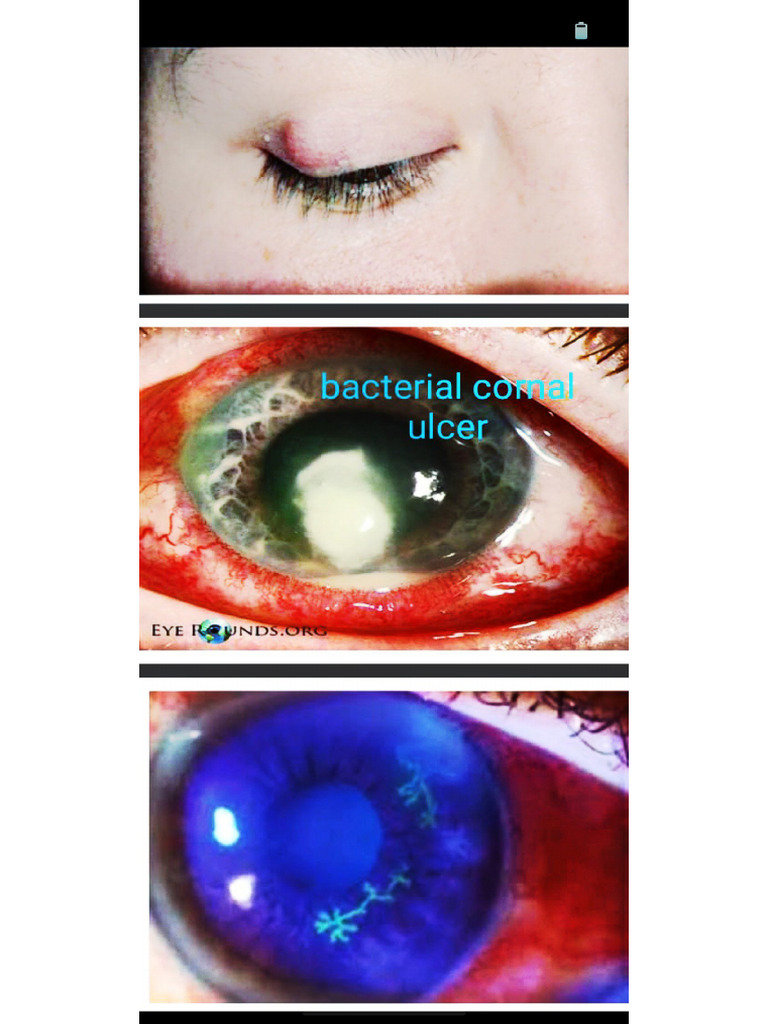 Ophtha Spots | PDF
