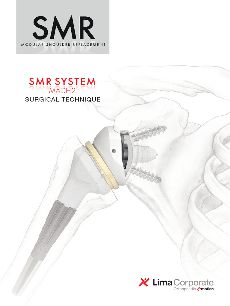 Smr-System Mach-II Eng v3 | PDF | Human Anatomy | Limbs (Anatomy)